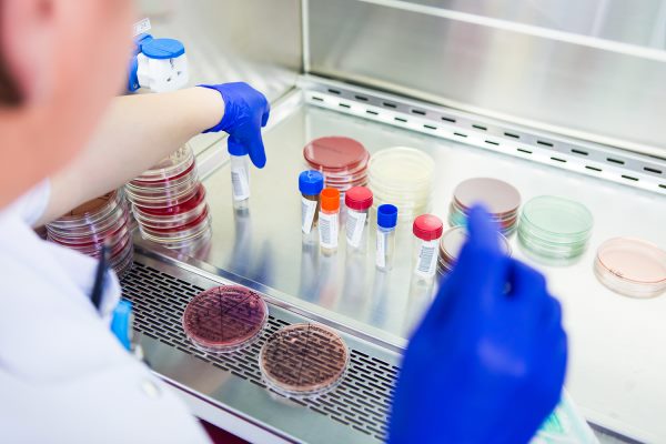 Povišeni limfociti (limfocitoza) uzrok i kako ih smanjiti – Simptomi ...