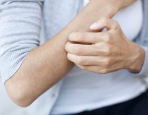 Modrice bez udarca mogući uzroci (modrice po nogama, rukama i telu ...