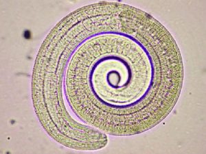 Trihineloza (trihinela) kod ljudi: Prvi simptomi, lečenje, uništavanje ...