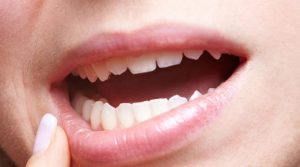 Umnjaci: Sve što bi trebalo da znate o njima (koliko traje rast, upala ...